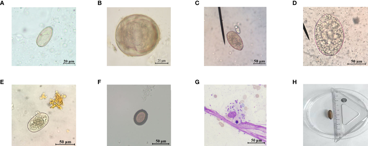 Frontiers | Foodborne Parasites Dominate Current Parasitic Infections ...