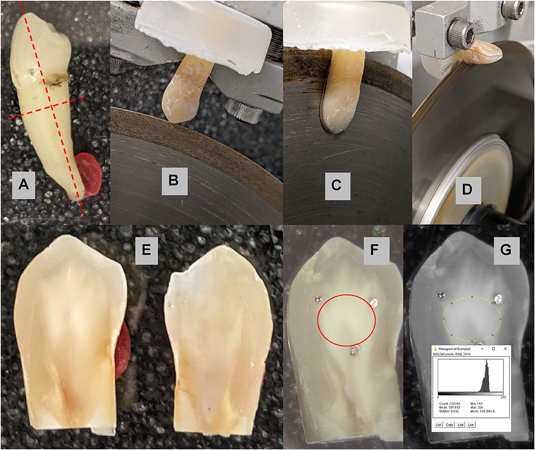 Frontiers | Effect of Temperature on Tooth Staining by 0.12% ...