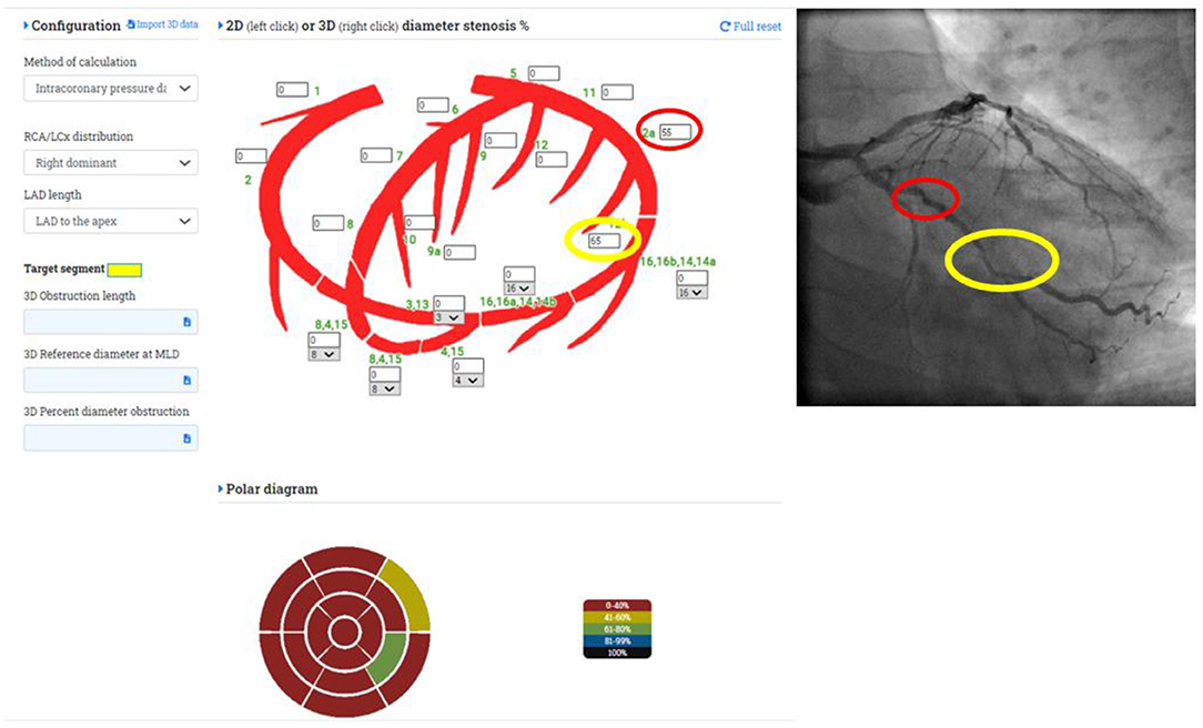 Frontiers | Anatomical Assessment vs. Pullback REsting full-cycle rAtio ...