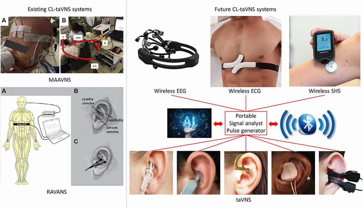 Frontiers | Closed-Loop Transcutaneous Auricular Vagal Nerve Stimulation: Current Situation and ...