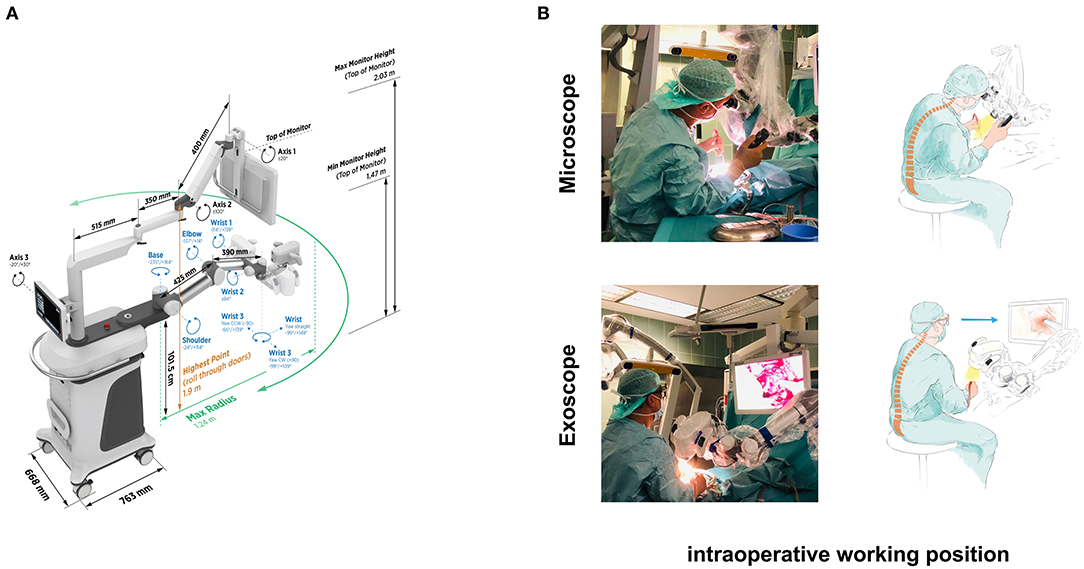 Frontiers | Evaluation of 3D Robotic-Guided Exoscopic Visualization in ...