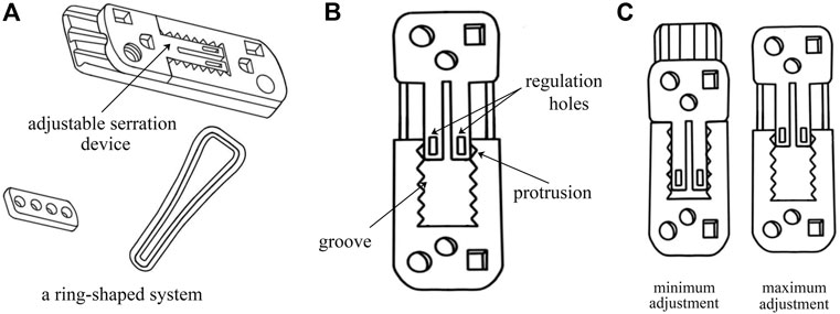 Frontiers | A Novel Adjustable EndoButton Fixation Assisted by 3D ...