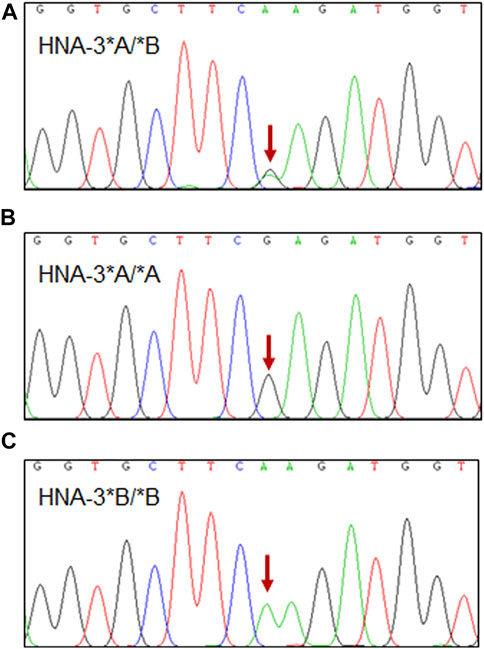 Frontiers | SLC44A2 Frequency, a New TaqMan Real-Time Polymerase Chain ...