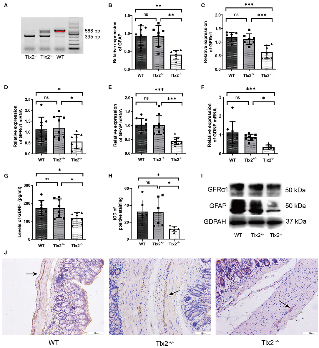 Frontiers | Role of GDNF, GFRα1 and GFAP in a Bifidobacterium ...