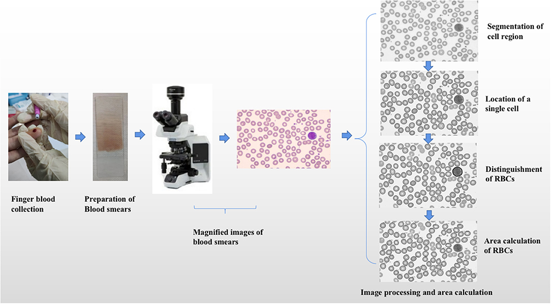 Frontiers | Measurement for the Area of Red Blood Cells From ...