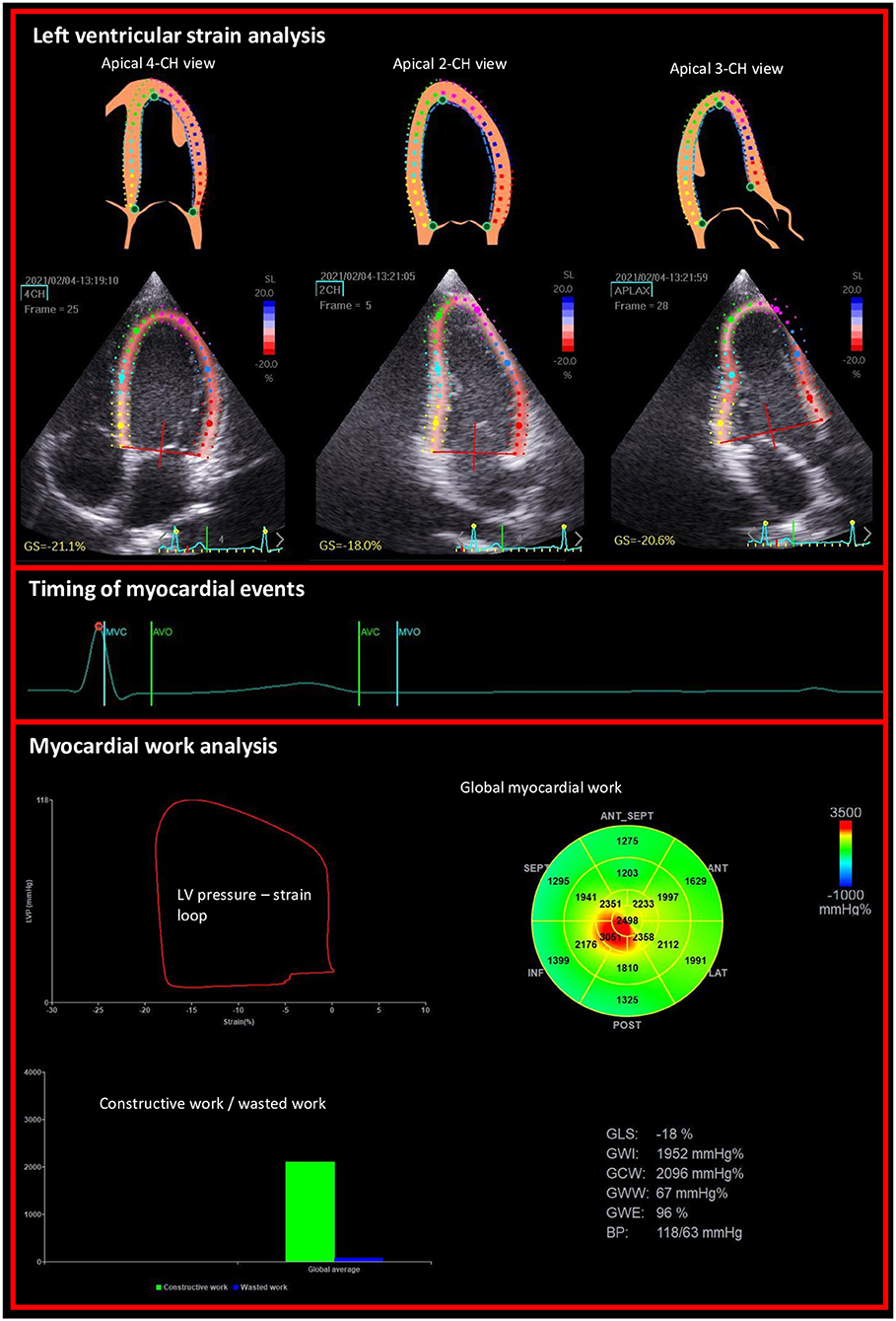 Frontiers | Left Ventricular Strains and Myocardial Work in Adolescents ...