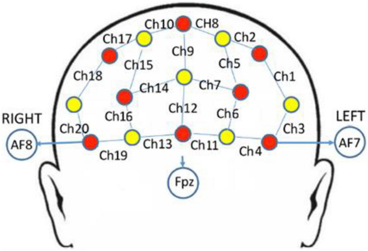 Frontiers | Effects of Acute Moderate- and High-Intensity Aerobic ...