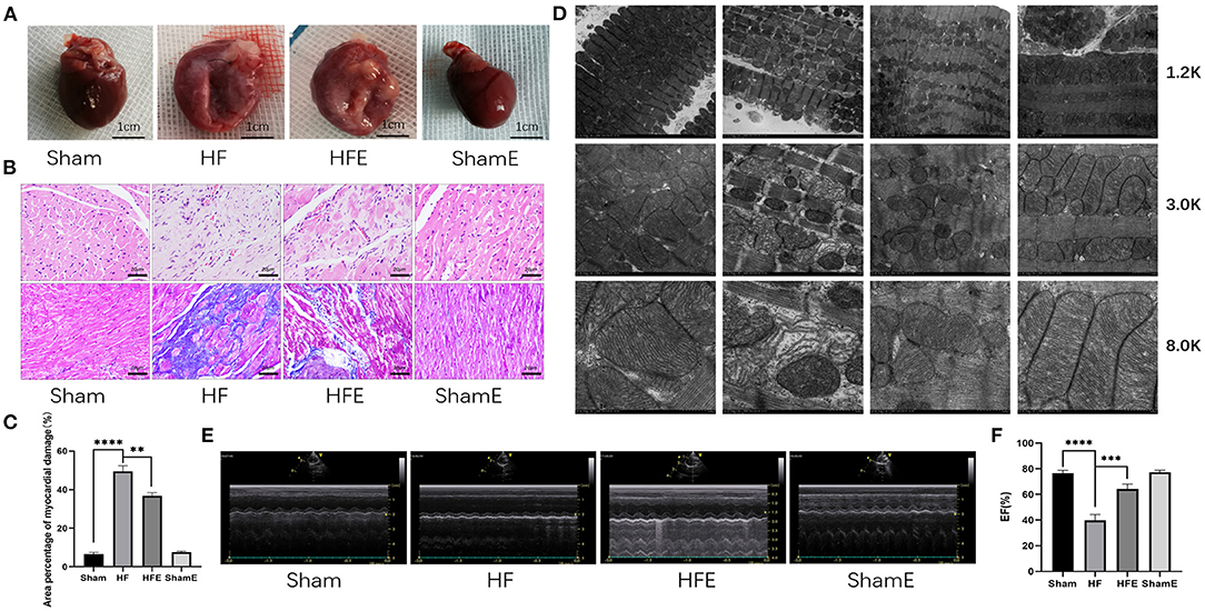 Frontiers | Exercise-Generated β-Aminoisobutyric Acid (BAIBA) Reduces ...