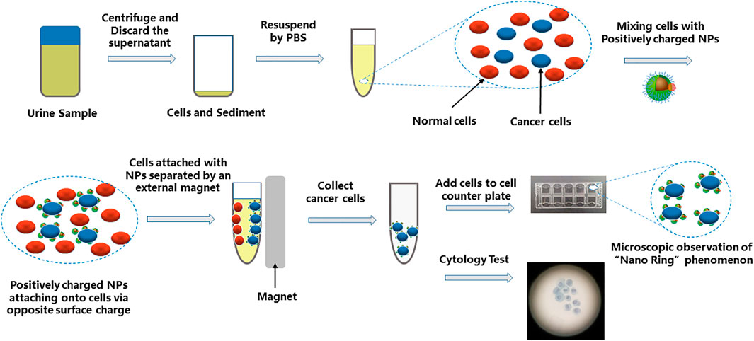 Frontiers | Novel Non-Invasive Diagnosis of Bladder Cancer in Urine ...