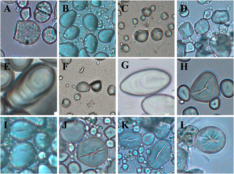 Frontiers | Description of Starch Granules From Edible Acorns (Oak ...