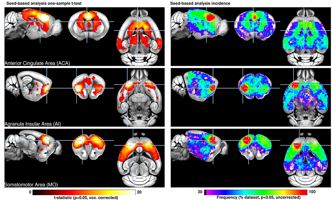 Frontiers | Monitoring Neuronal Network Disturbances of Brain Diseases ...