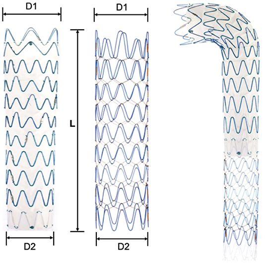 Frontiers | Clinical Results and Aortic Remodeling After Endovascular ...
