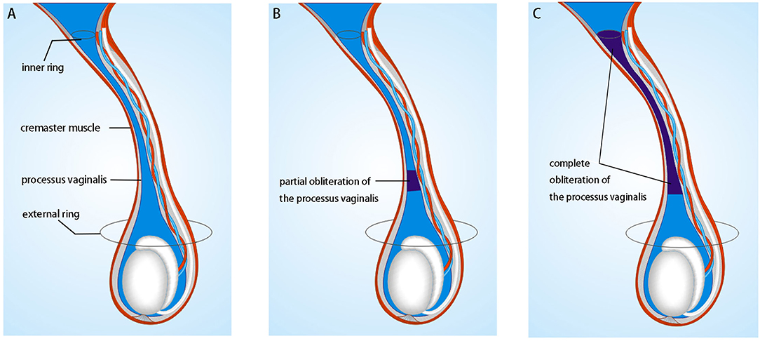 Frontiers | Comparison of the Detection and Ligation of Patent ...