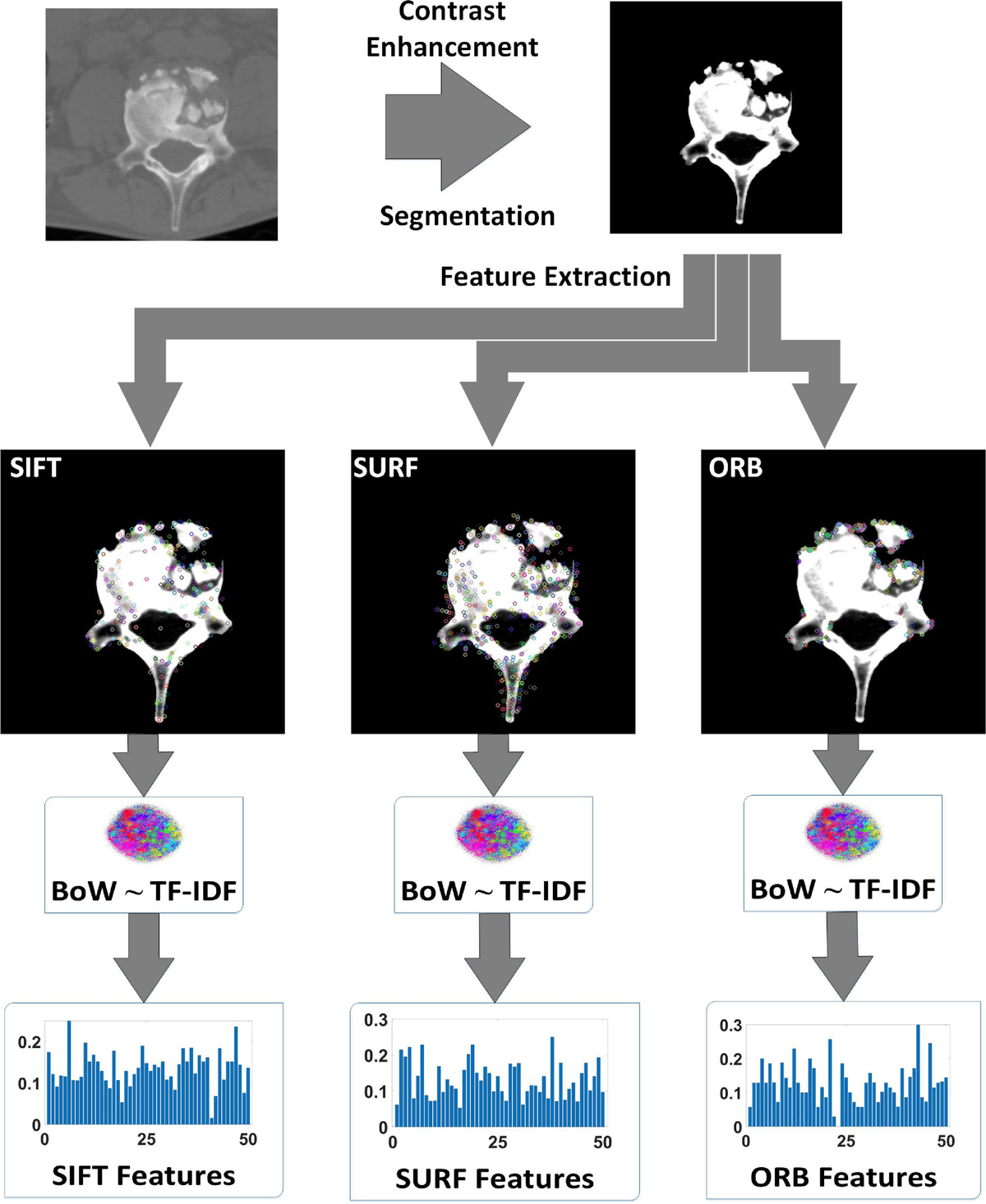 Frontiers | Computer-Aided Diagnosis of Spinal Tuberculosis From CT ...