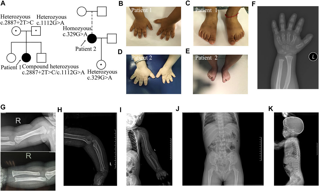 Frontiers | Novel Loss-of-Function Mutations in NPR2 Cause ...