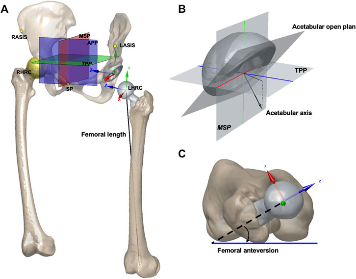 Frontiers | Postoperative Hip Center Position Associated With the Range ...