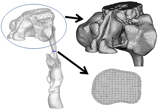 Frontiers | Prediction of Moderate to Severe Obstructive Sleep Apnea Using Neck Computed ...