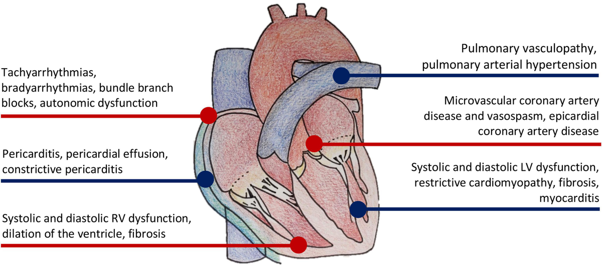 Frontiers | Cardiovascular Imaging for Systemic Sclerosis Monitoring ...