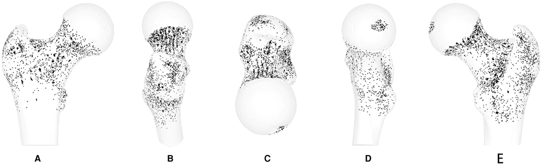 Frontiers | 3D Mapping of Bone Channel of Blood Supply to Femoral Head ...