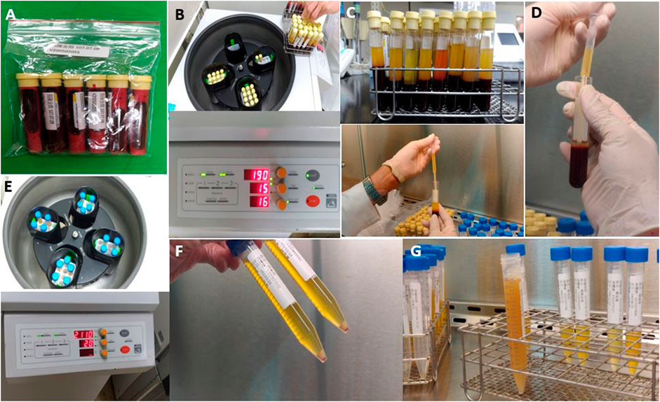 Frontiers | Therapeutic Efficacy of Intravesical Platelet-Rich Plasma ...