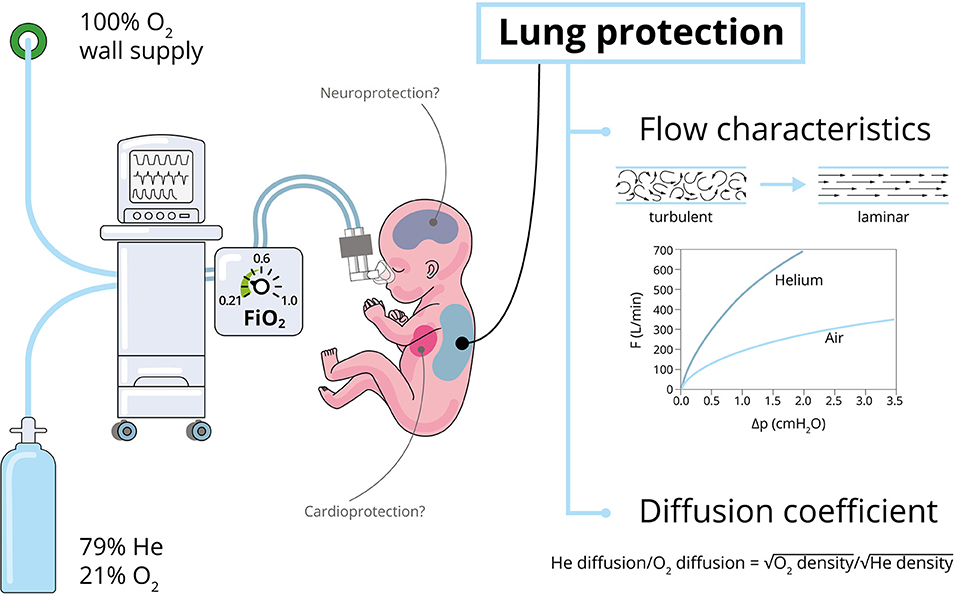 Frontiers | Neonatal Applications of Heliox: A Practical Review
