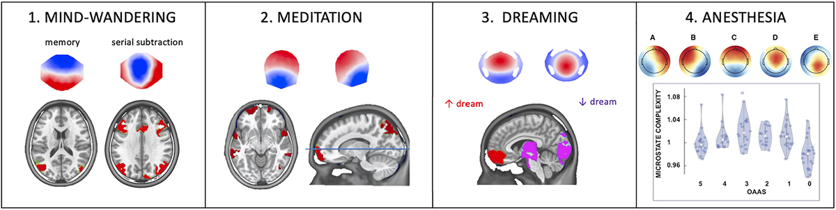 Frontiers | EEG Microstates in Altered States of Consciousness