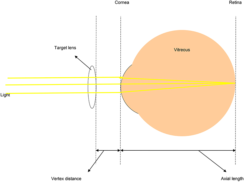 Frontiers | Vergence Formula for Estimating the Refractive Status of ...