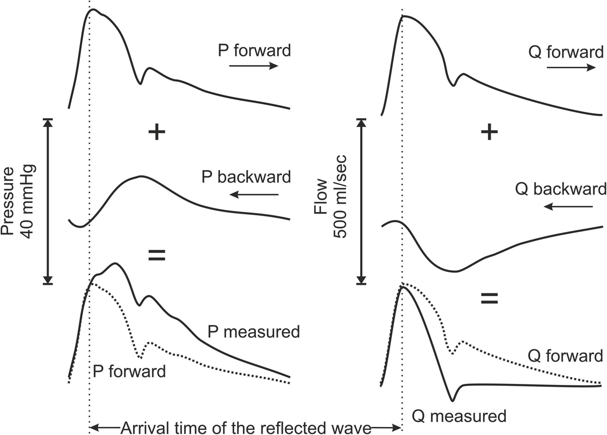 Frontiers | Arterial Wave Reflection and Aortic Valve Stenosis ...