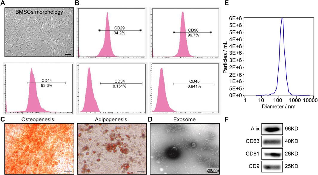 Frontiers | Exosomes Derived From CTF1-Modified Bone Marrow Stem Cells ...