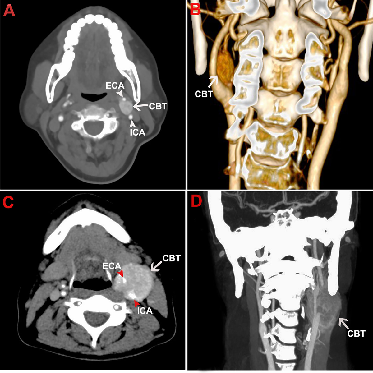 Frontiers | Comparison of Contrast-Enhanced Ultrasonography to Color ...