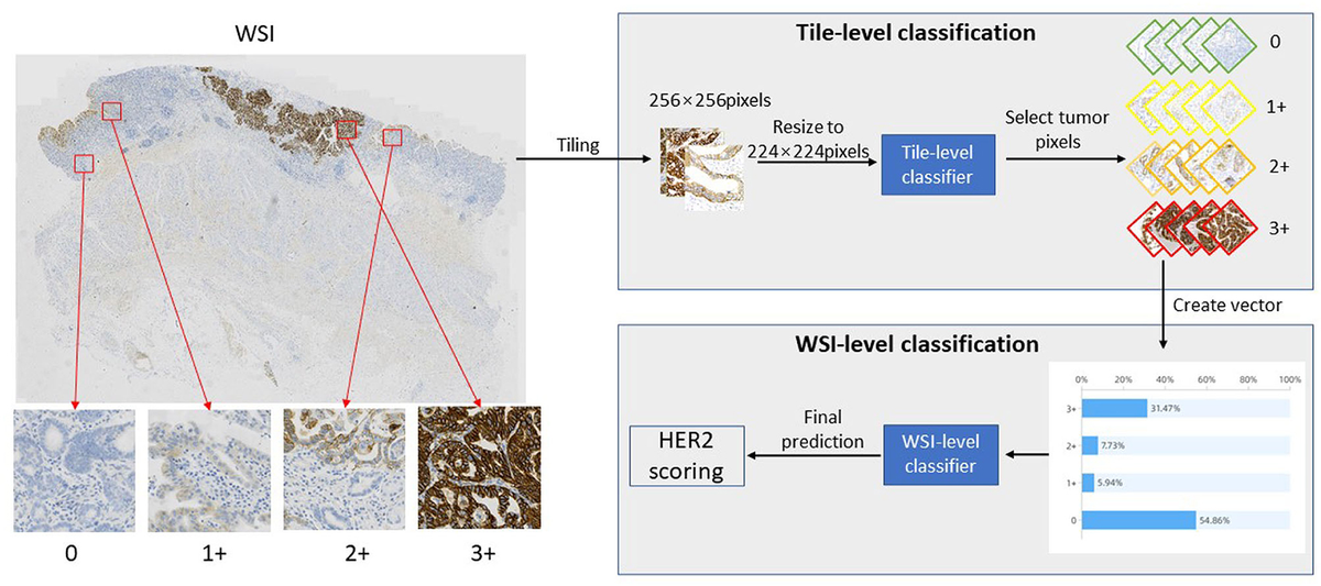 Frontiers | A Deep Learning Quantification Algorithm for HER2 Scoring of Gastric Cancer