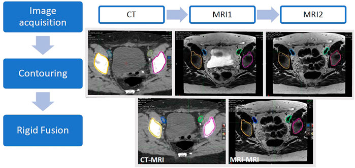 Frontiers | Repeatability of MRI for radiotherapy planning for pelvic ...