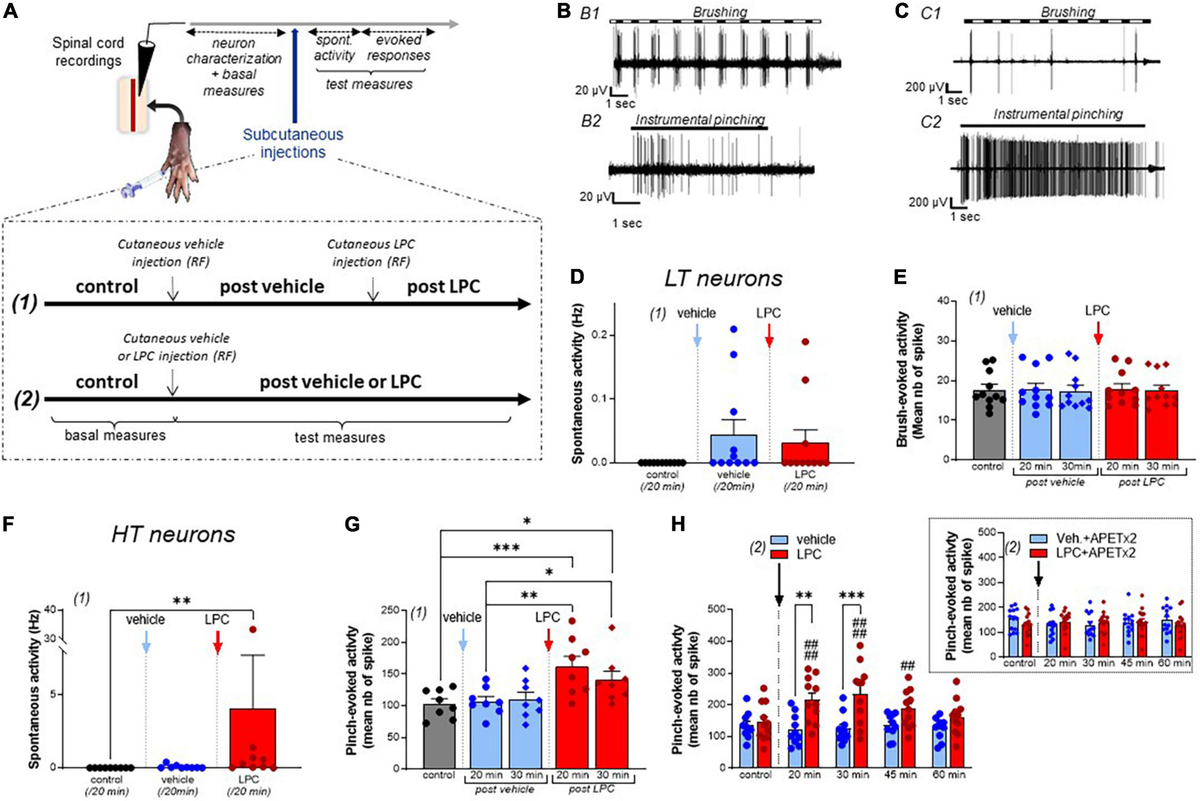 Frontiers | Single Subcutaneous Injection of Lysophosphatidyl-Choline ...