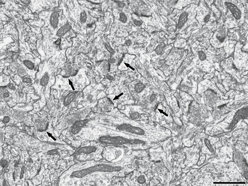 Frontiers | Espina: A Tool for the Automated Segmentation and Counting of Synapses in Large ...