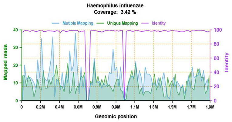 Frontiers | Intrapleural injection of urokinase in the treatment of ...