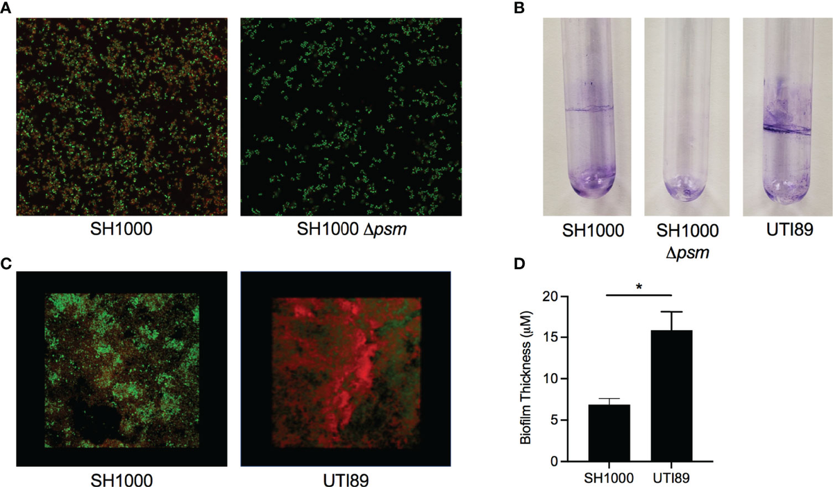 Frontiers | Phenol-Soluble Modulins From Staphylococcus aureus Biofilms ...