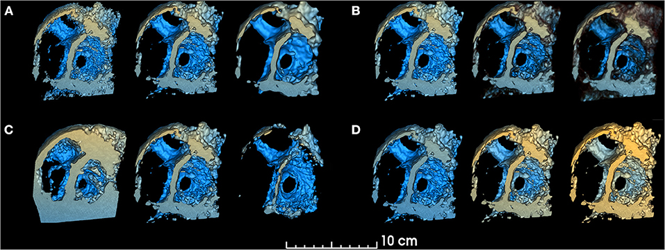 Frontiers | SlicerHeart: An open-source computing platform for cardiac image analysis and modeling