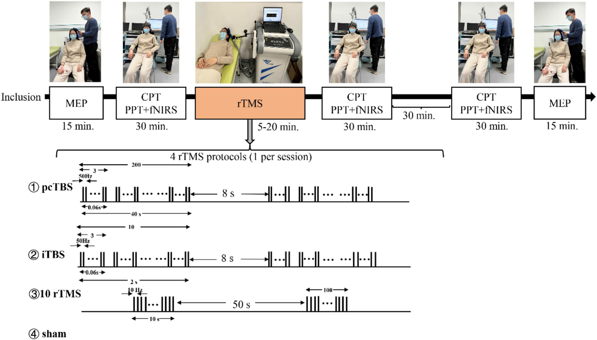 Frontiers | Prolonged Continuous Theta Burst Stimulation Can Regulate Sensitivity on Aβ Fibers ...