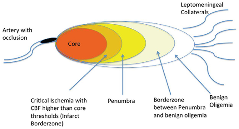 Frontiers | Non-invasive Brain Temperature Measurement in Acute ...