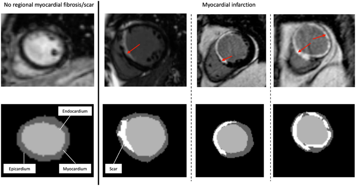 Frontiers | Predicting post-contrast information from contrast agent ...