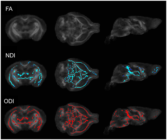 Frontiers | 18F-SynVesT-1 PET/MR Imaging of the Effect of Gut Microbiota on Synaptic Density and ...