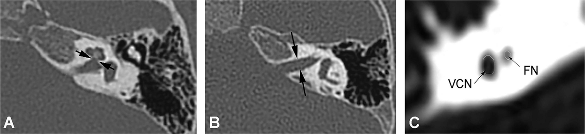 Frontiers | Machine Learning-Based Prediction of the Outcomes of ...