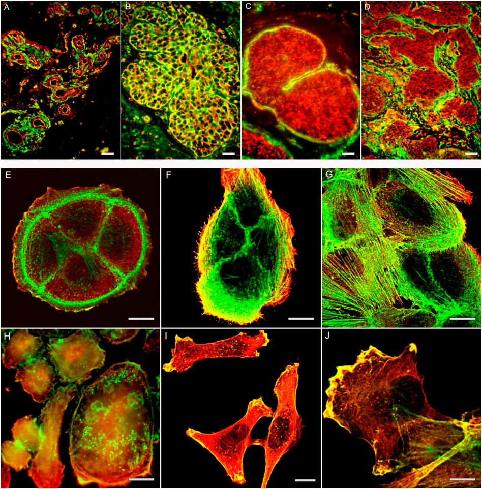 Frontiers | Cytoplasmic Beta and Gamma Actin Isoforms Reorganization ...