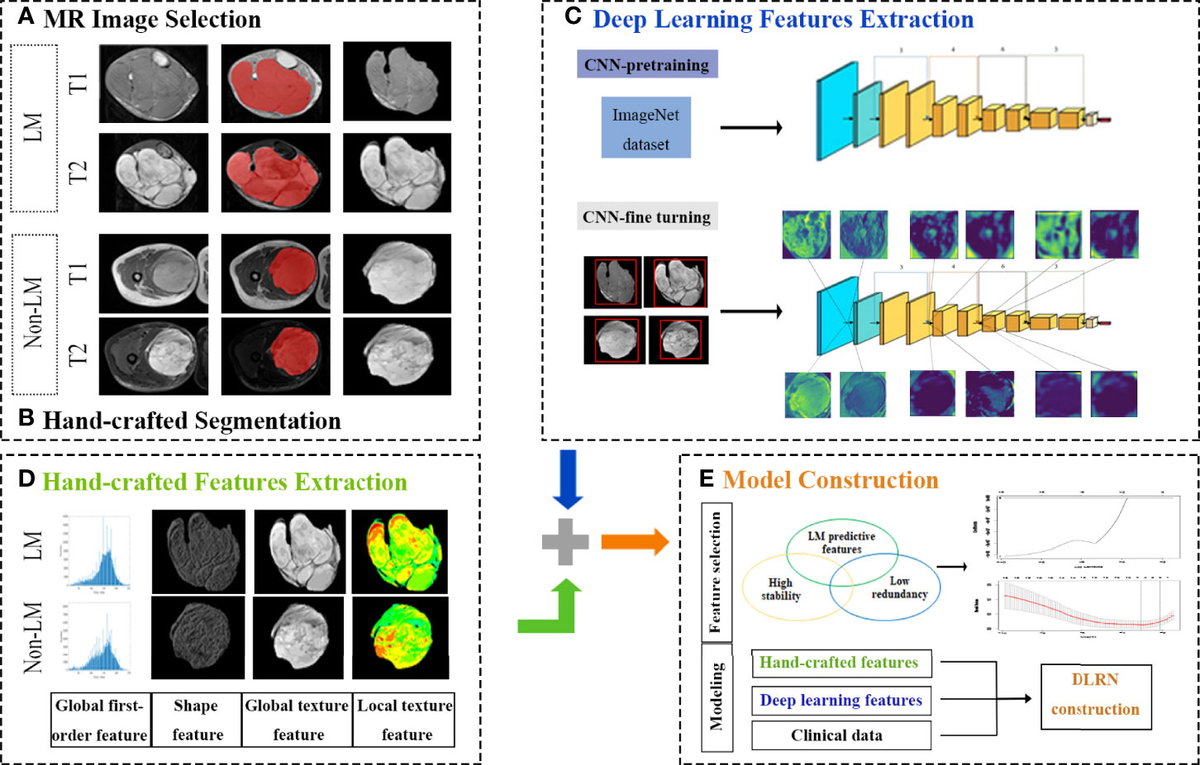 Frontiers | Deep Learning Radiomics Nomogram to Predict Lung Metastasis in Soft-Tissue Sarcoma ...