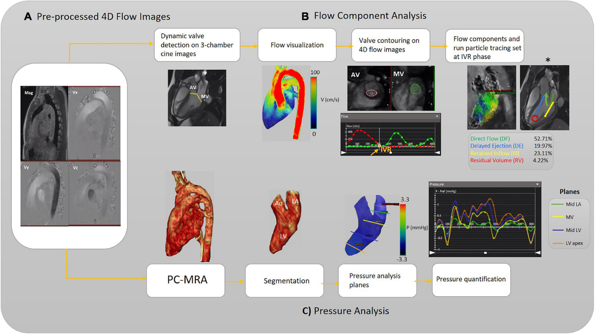 Frontiers | Intra-cardiac pressure drop and flow distribution of ...