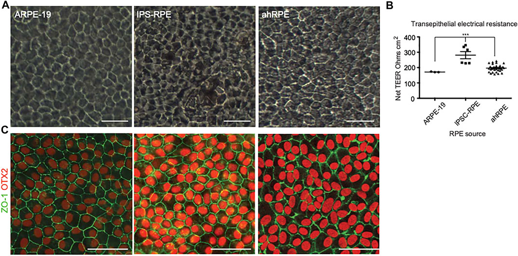 Frontiers | Transcriptional comparison of adult human primary Retinal ...
