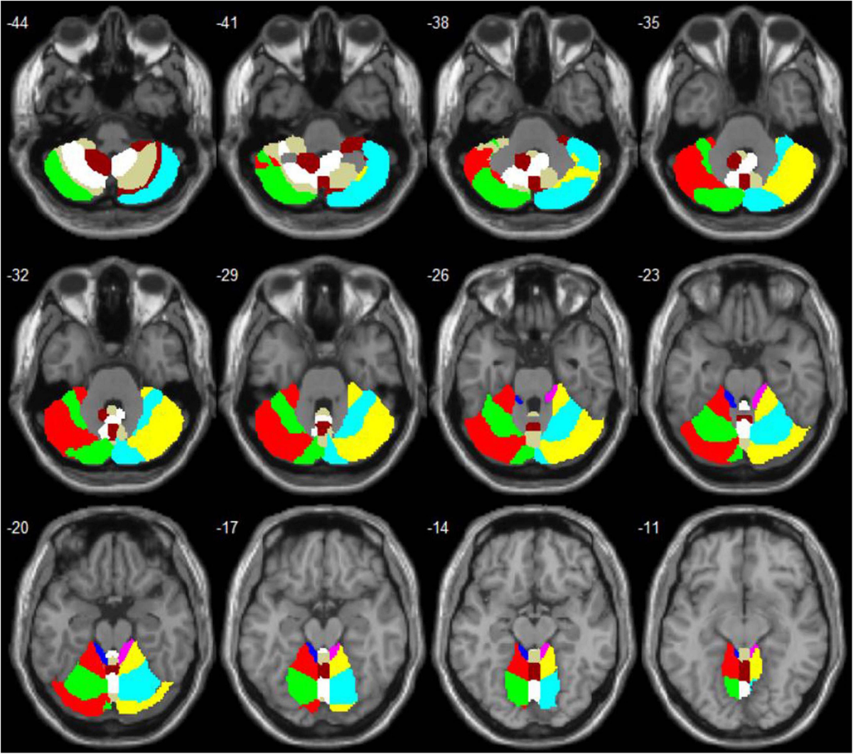 Frontiers | Cerebellum regulating cerebral functional cortex through ...