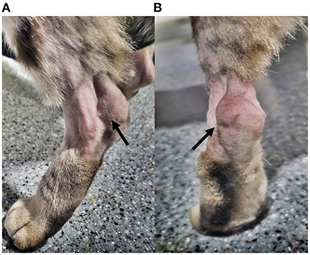 Frontiers | Case report: Primary chronic calcaneal bursitis treated ...