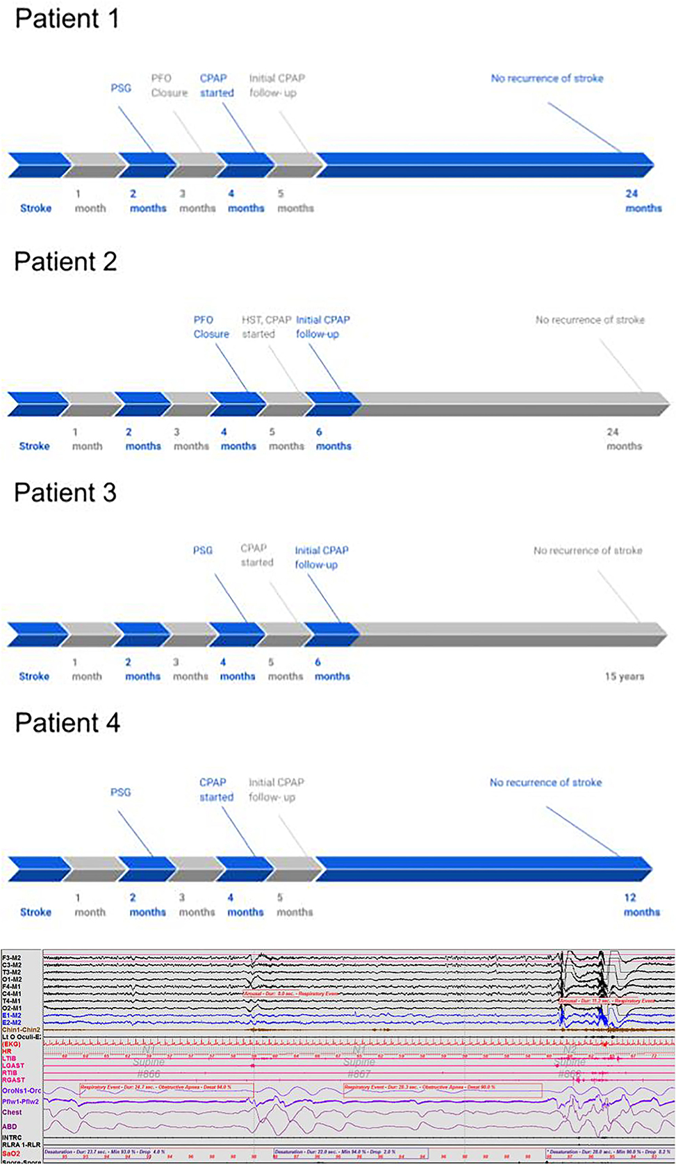 Frontiers | Obstructive Sleep Apnea (OSA) and Patent Foramen Ovale (PFO ...