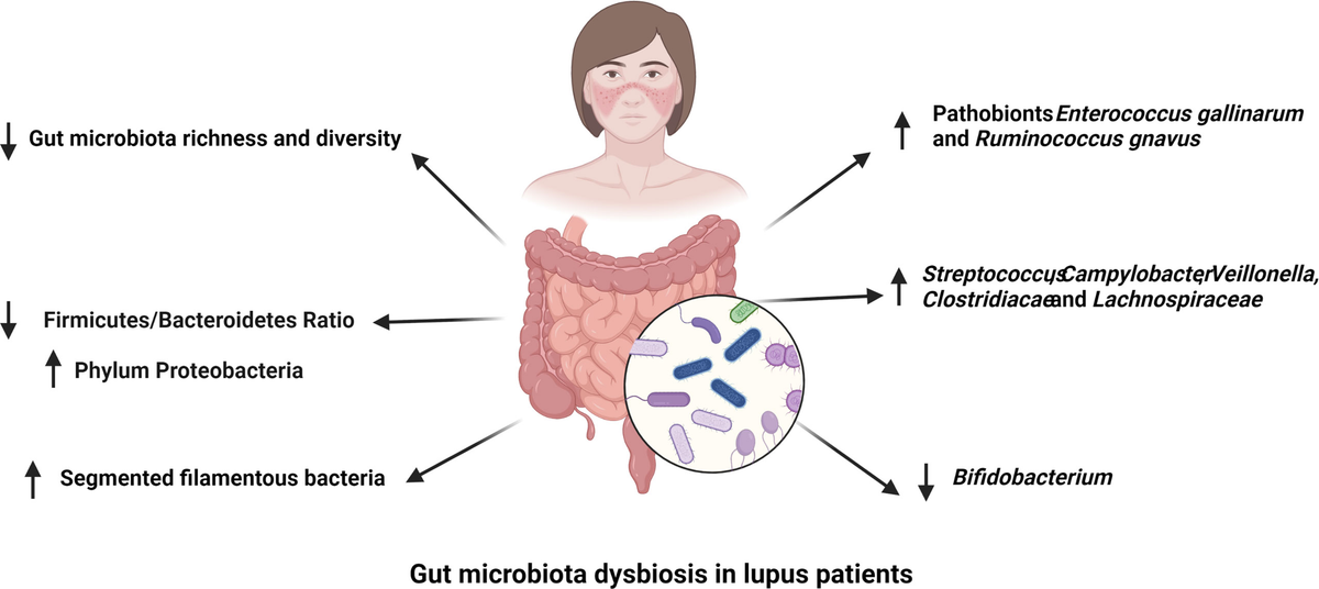 Frontiers | Loss of Gut Barrier Integrity In Lupus